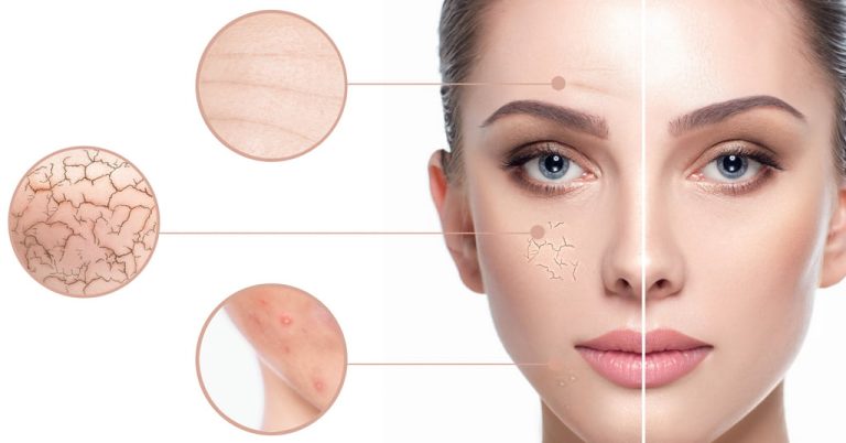 8 Reasons Hyaluronic Acid is a Game-Changer for Your Skin