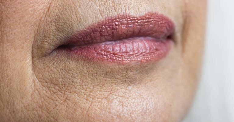 Lip Wrinkles and its science behind causes, prevention and Top 7 Solutions