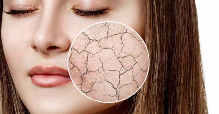 How to heal damaged skin barrier with 5 amazing skin care tips